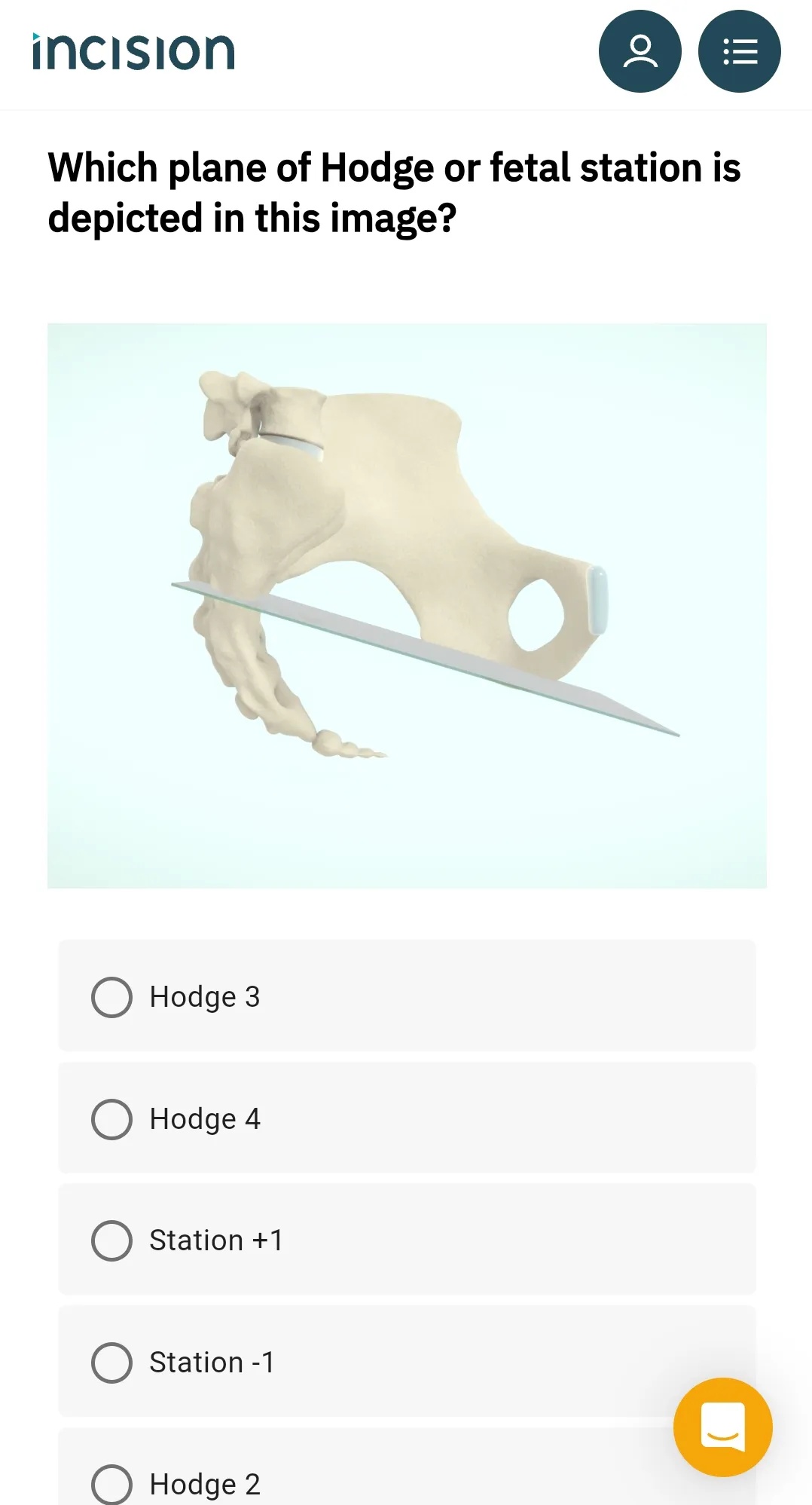 Which plane of Hodge or fetal station is | StudyX