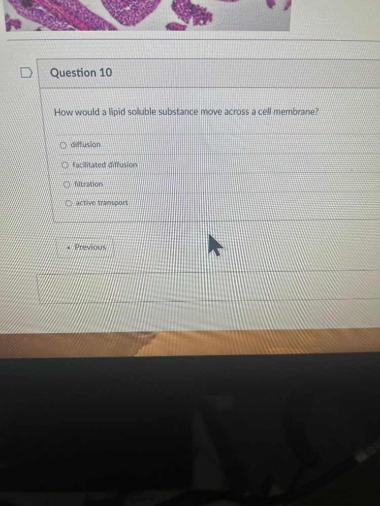 Question 10 How would a lipid soluble | StudyX