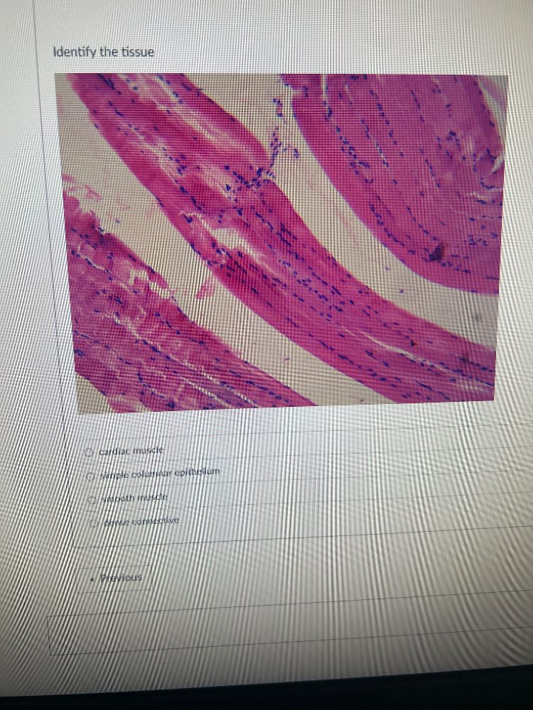 Identify the tissue. * cardiac muscle * | StudyX