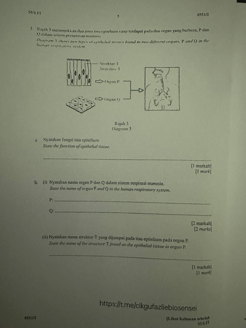 3. Rajah 3 menunjukkan dua jenis tisu | StudyX