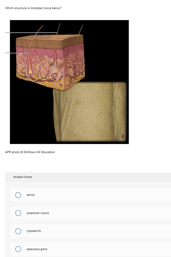 Which structure is indicated twice below? | StudyX