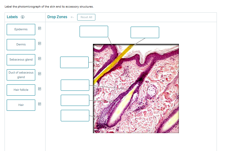 Label the photomicrograph of the skin and | StudyX