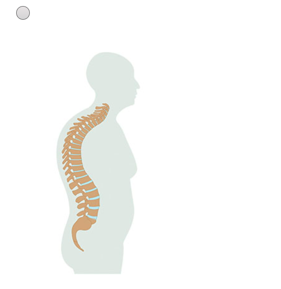 A nurse is assessing the spinal curvature of | StudyX