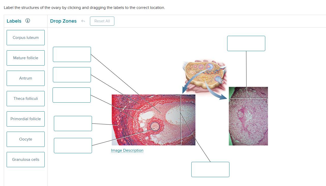 Label the structures of the ovary by