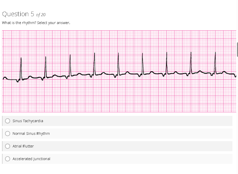 Question 5 of 20 What is the rhythm? Select | StudyX