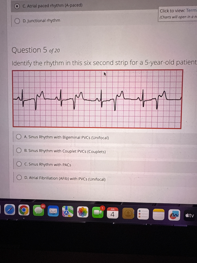 Question 5 of 20 Identify the rhythm in this | StudyX