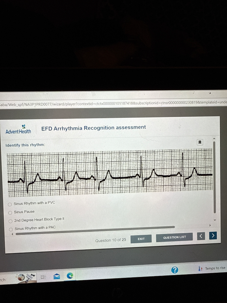 Identify this rhythm Insert ECG image here | StudyX
