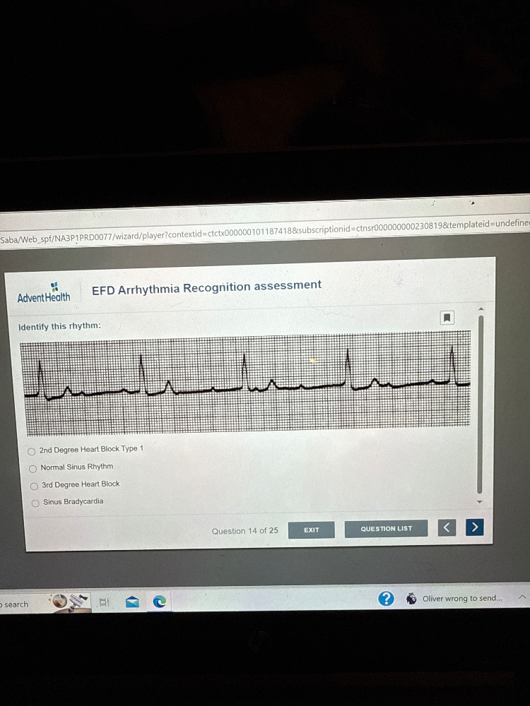 Identify this rhythm Insert ECG image here | StudyX