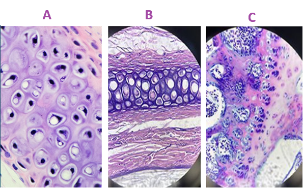 Identify the type of cartilage shown in the | StudyX