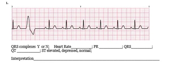 QRS complexes Y or N; Heart Rate _____; PR | StudyX