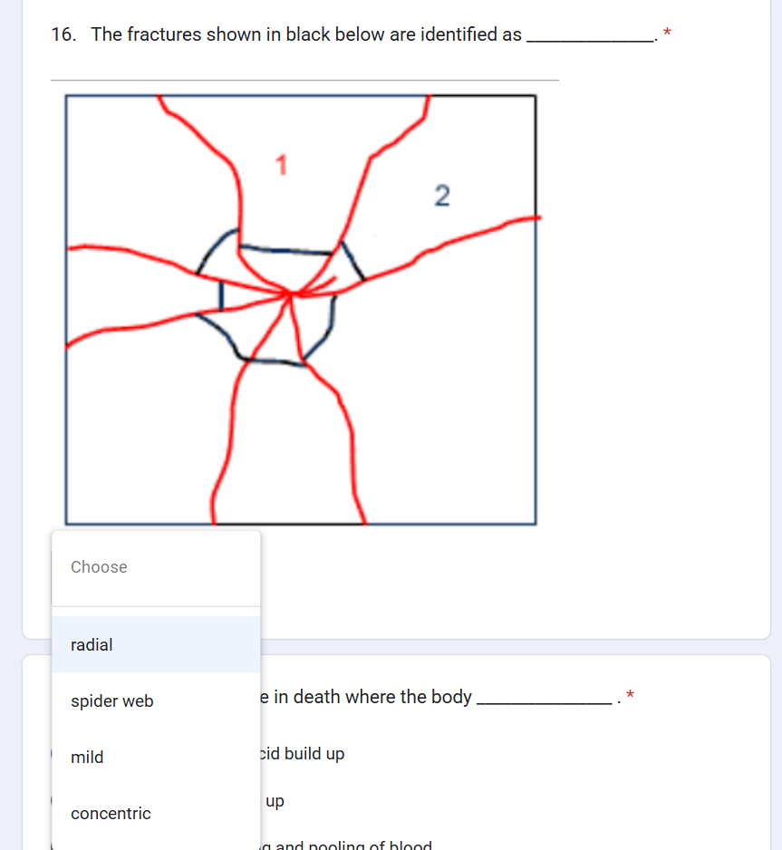 16. The fractures shown in black below are | StudyX