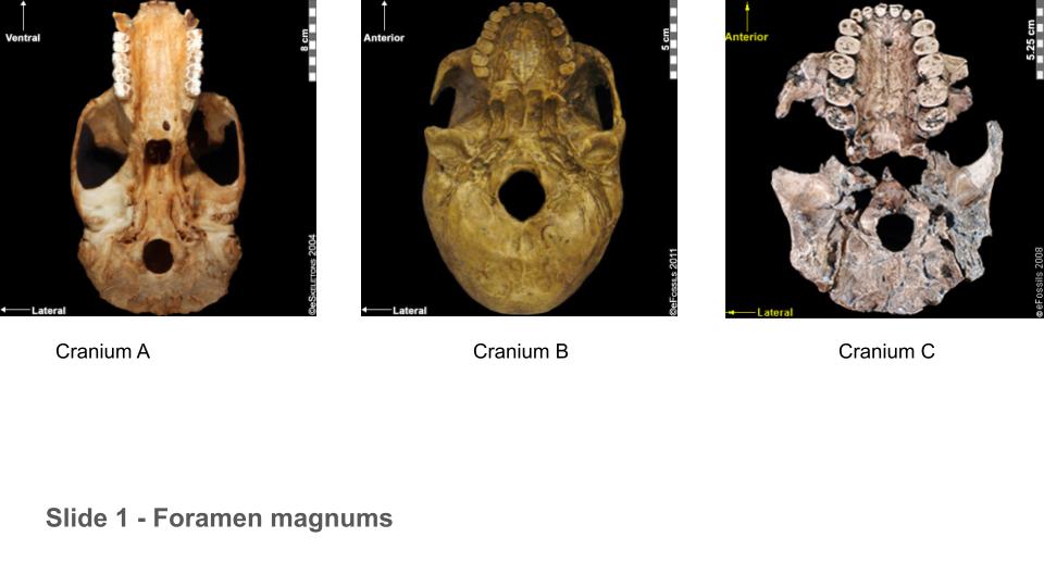 Cranium A Cranium C Slide 1 - Foramen | StudyX