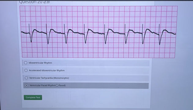 Question 20 of 20 Idioventricular Rhythm | StudyX