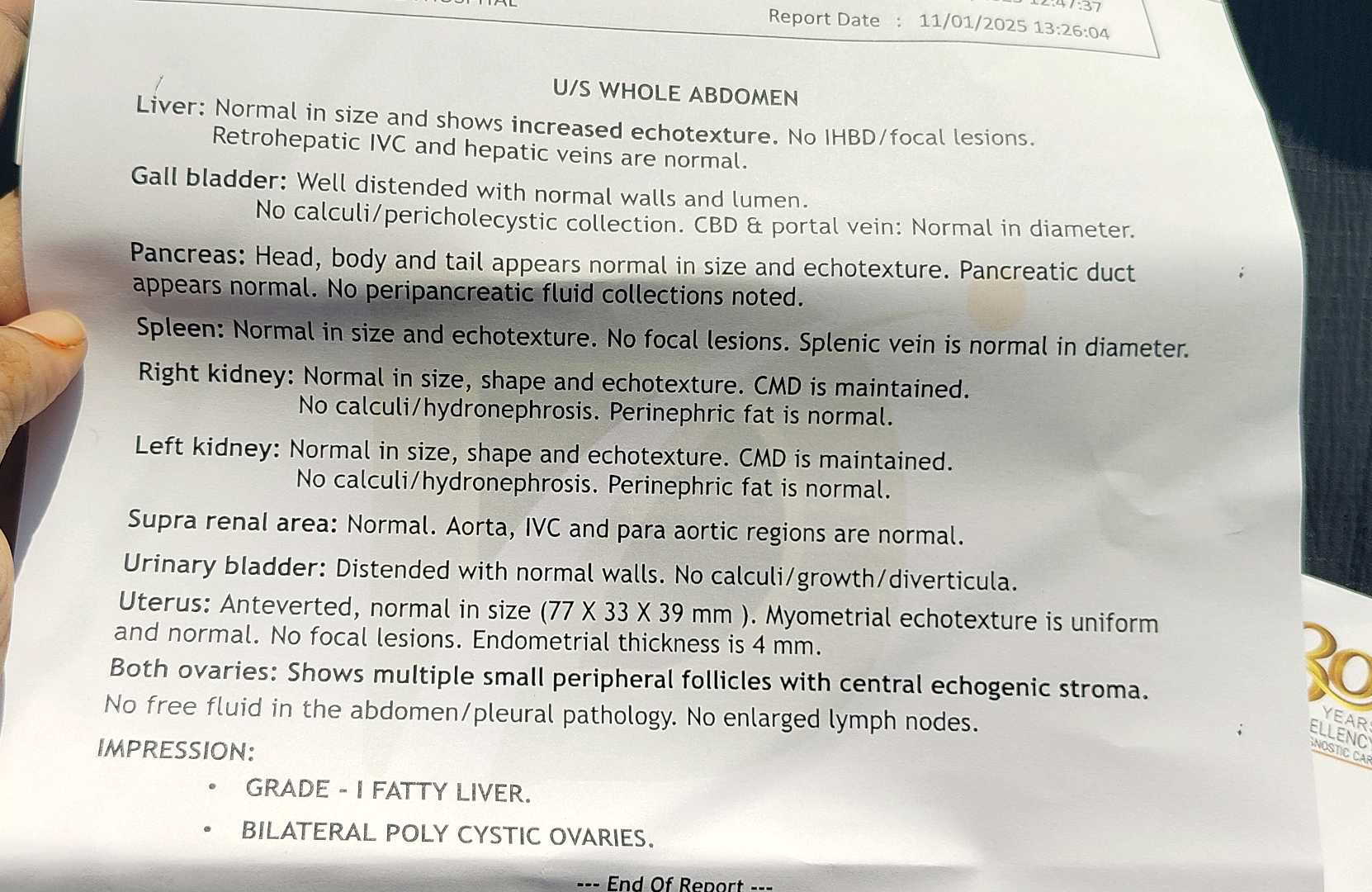 U/S WHOLE ABDOMENLiver Normal in size and | StudyX
