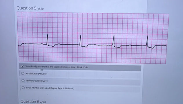 Question 5 of 20 Sinus Bradycardia with a | StudyX