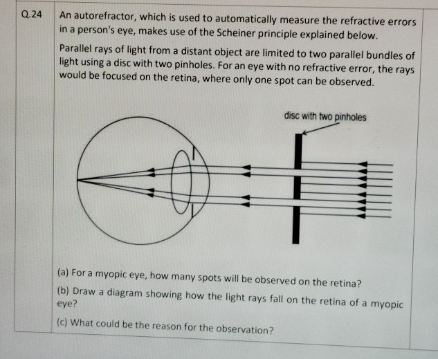 Q24 An autorefractor which is used to | StudyX