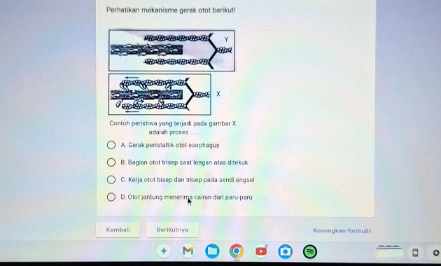 Perhatikan mekanisme gerak otot berikut | StudyX