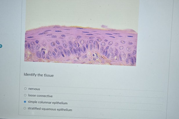 Identify the tissue nervous loose | StudyX