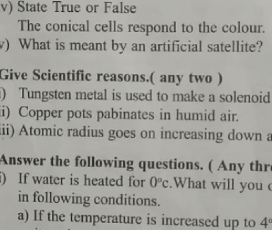 v) State True or False The conical cells | StudyX