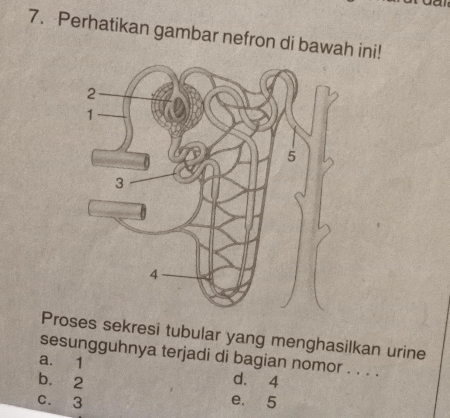 7 Perhatikan gambar nefron di bawah ini | StudyX