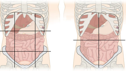 The image contains two diagrams showing the | StudyX