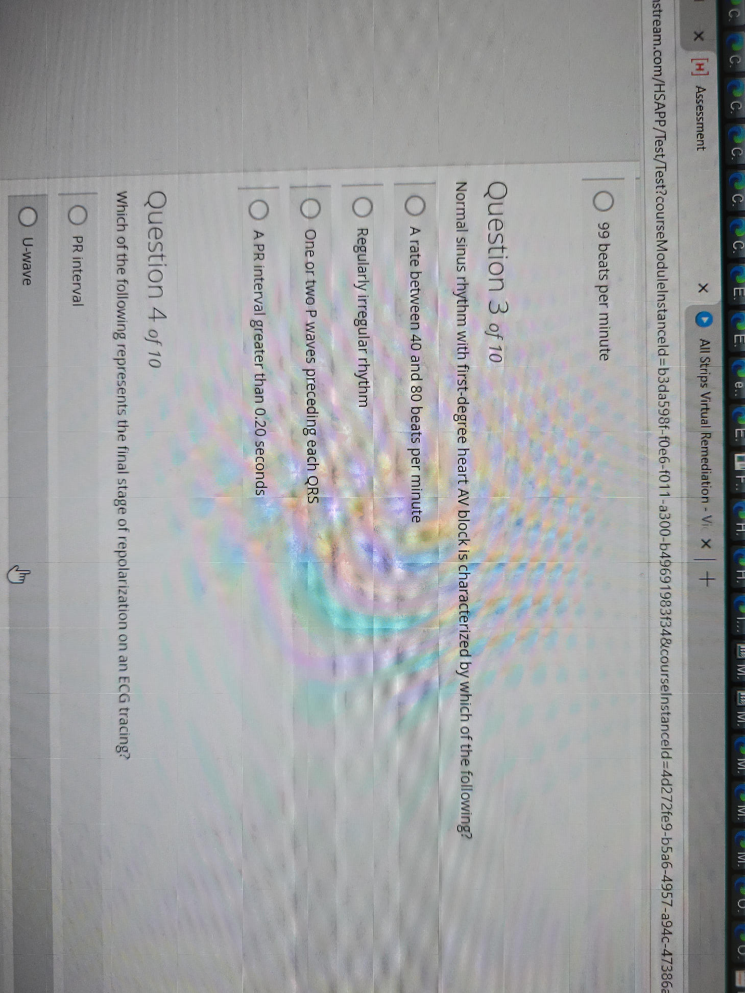 Question 3 of 10 Normal sinus rhythm with | StudyX