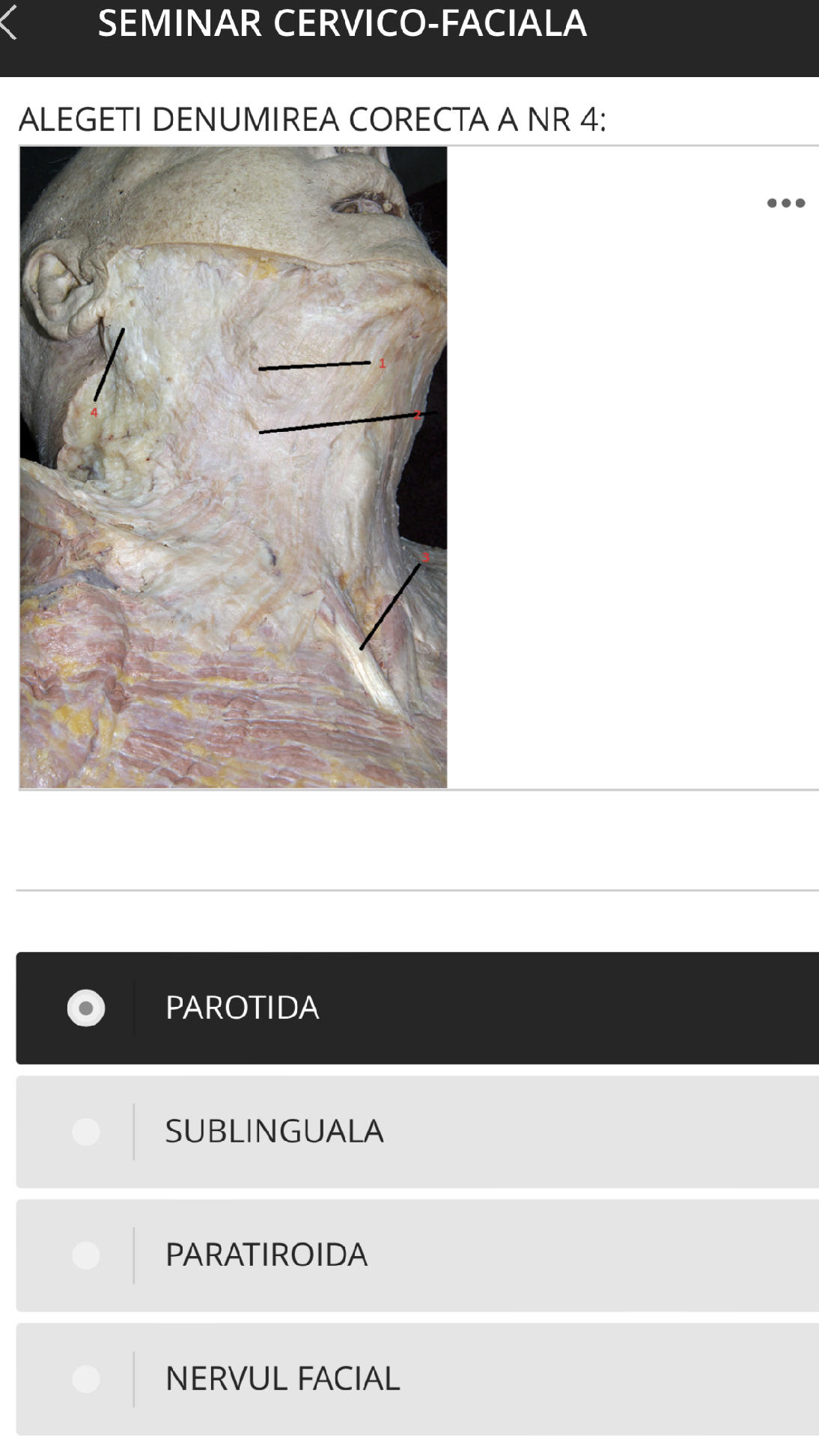ALEGETI DENUMIREA CORECTA A NR 4: PAROTIDA | StudyX