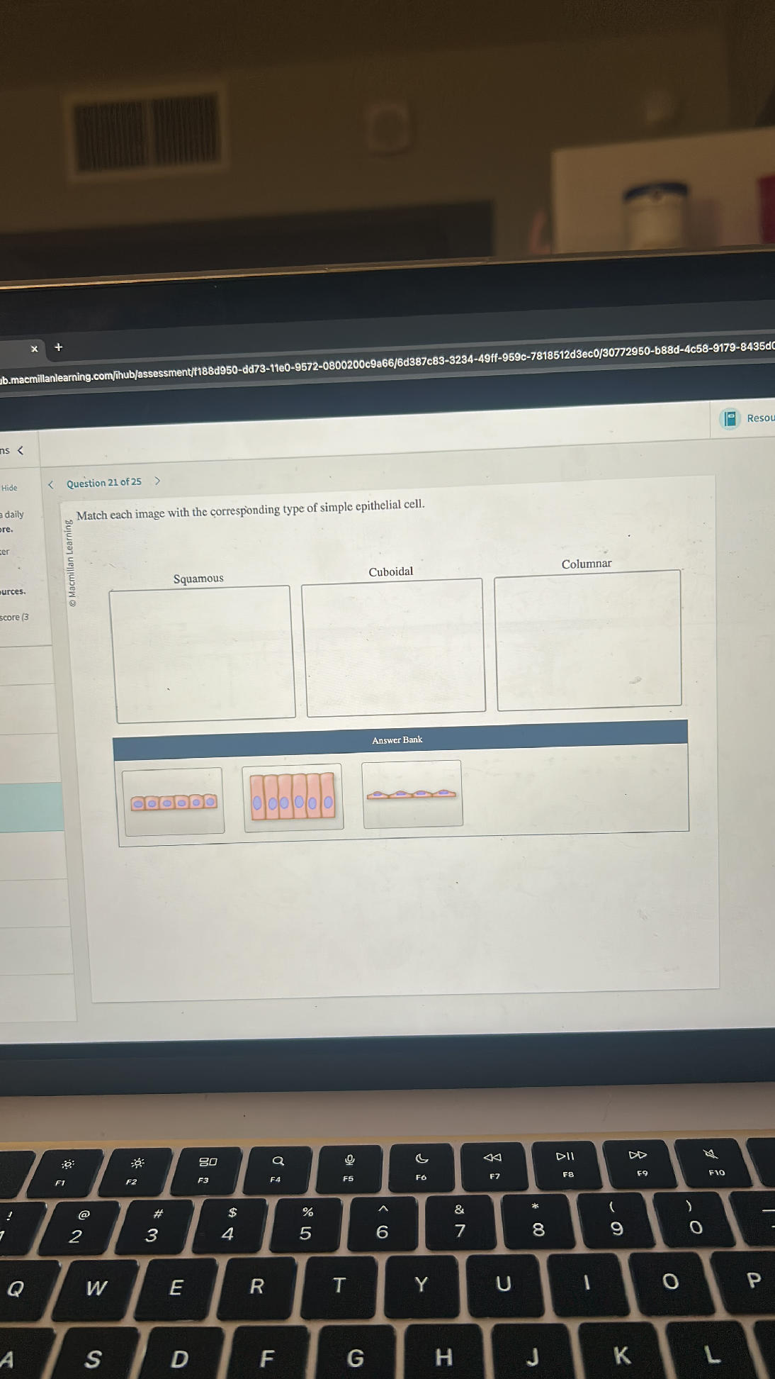 Match each image with the corresponding type | StudyX