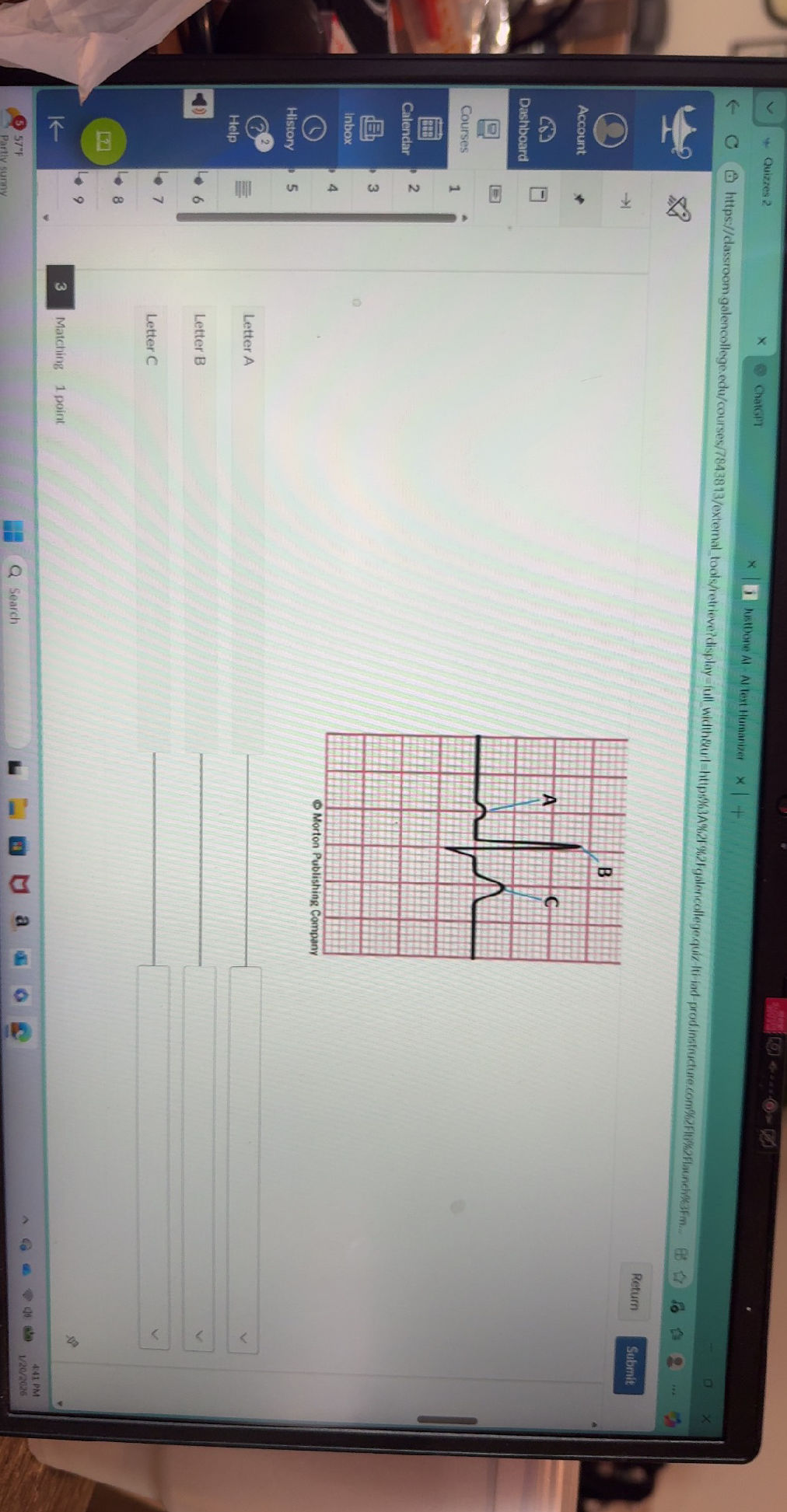 Matching 1 point [Image of an ECG graph | StudyX