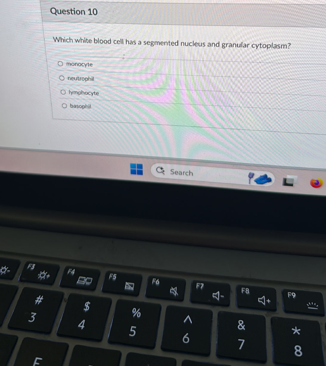 Which white blood cell has a segmented | StudyX