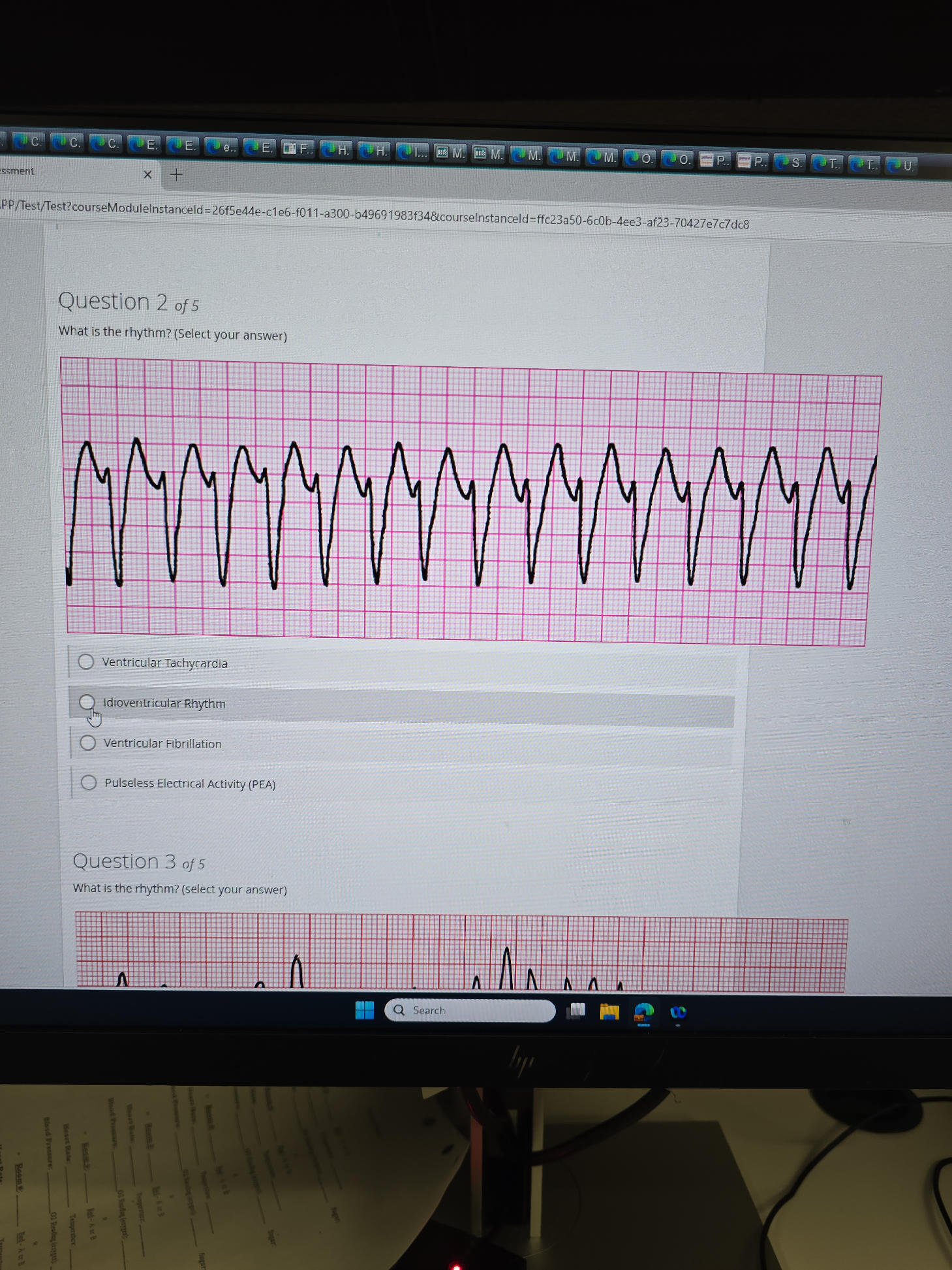 Question 2 of 5 What is the rhythm? (Select | StudyX