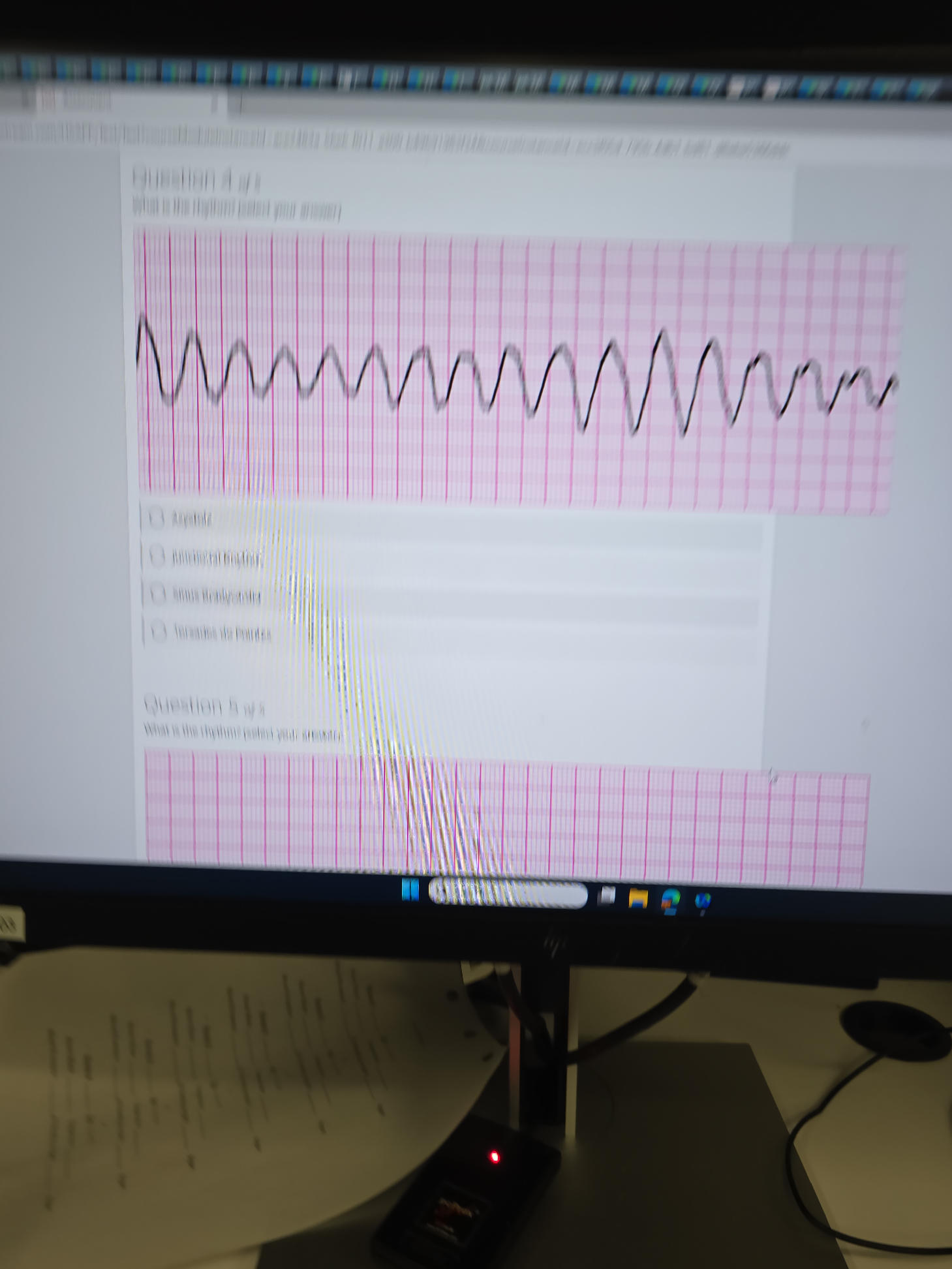 Question 4 of 5 What is the rhythm? (select | StudyX