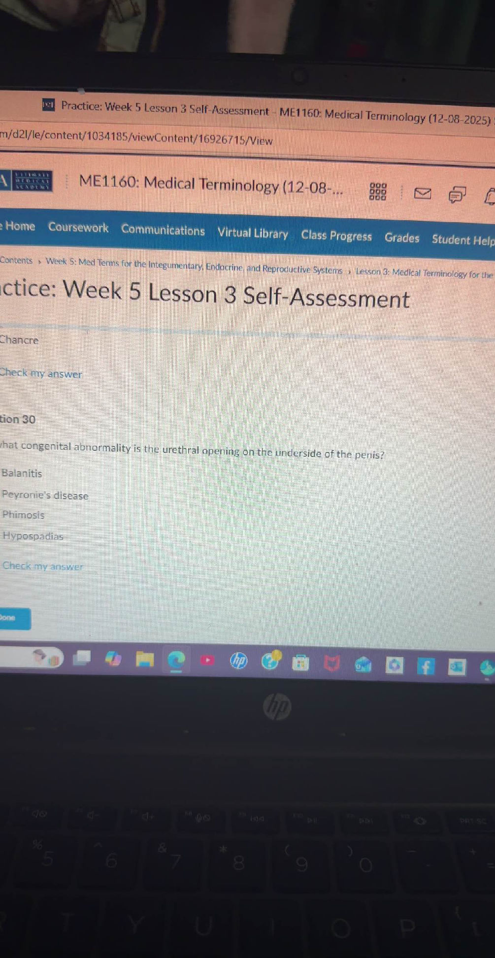 What congenital abnormality is the urethral | StudyX