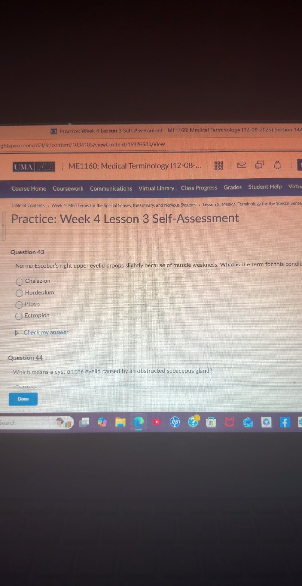 Norma Escobar's right upper eyelid droops | StudyX