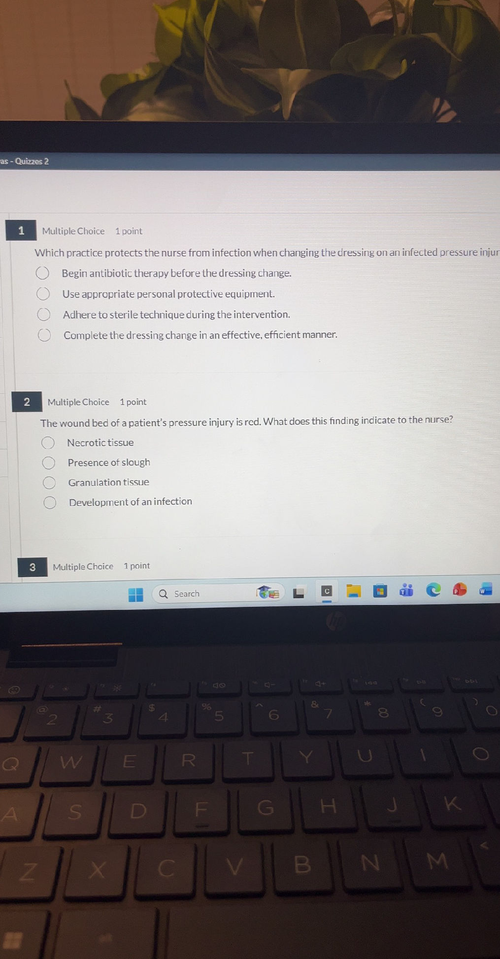 Multiple Choice 1 point The wound bed of a | StudyX
