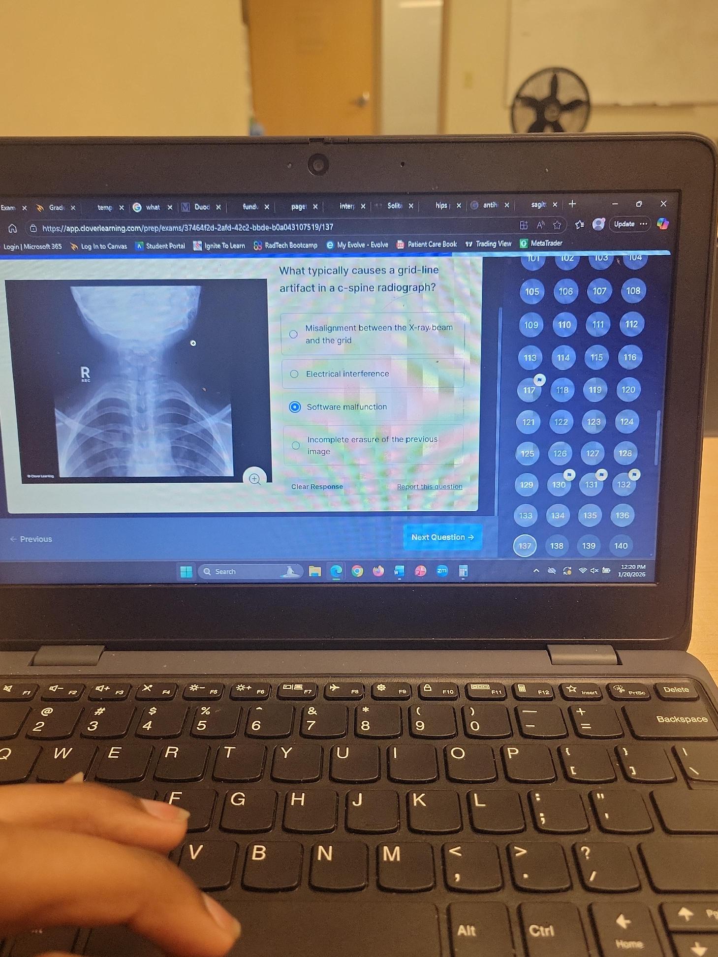 What typically causes a grid-line artifact | StudyX