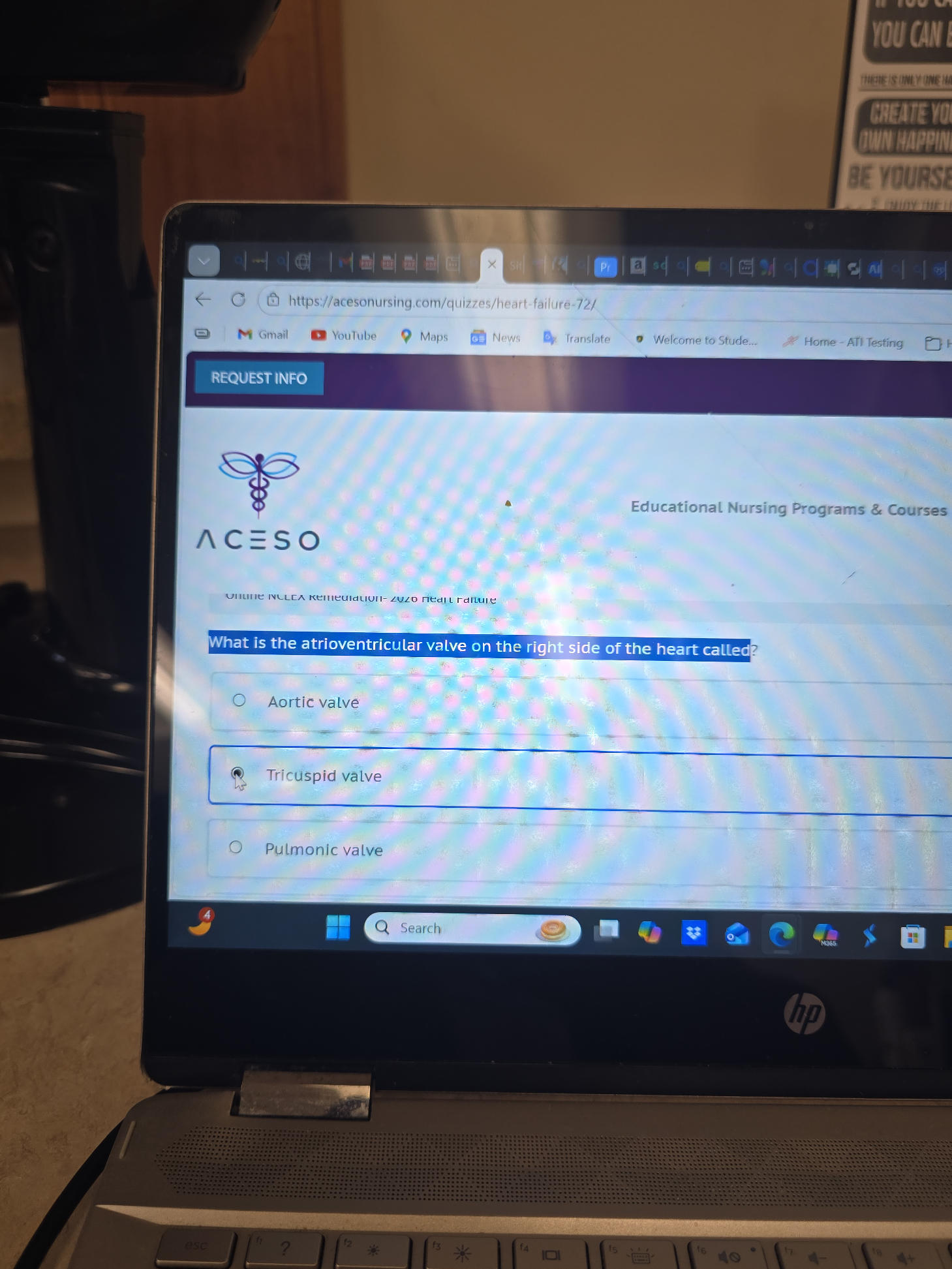 What is the atrioventricular valve on the | StudyX