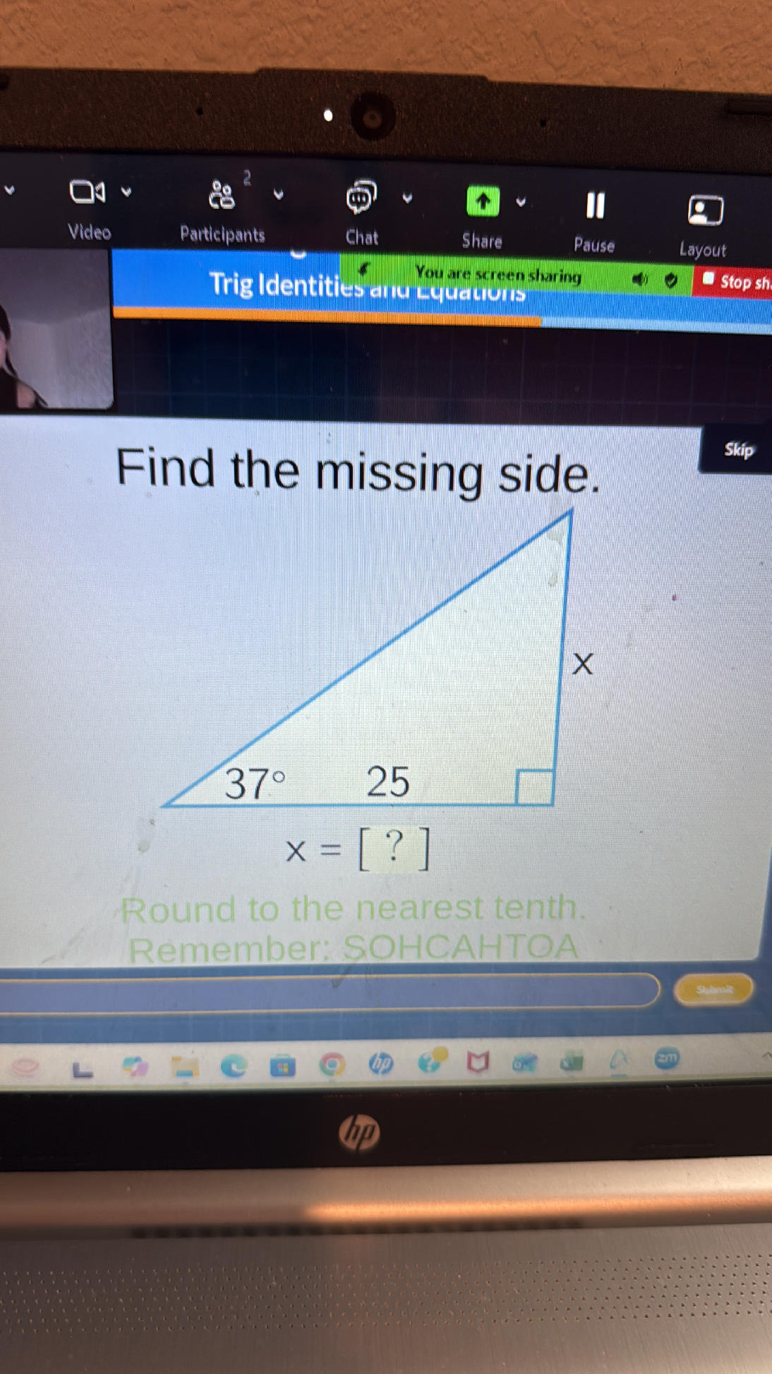 Find the missing side. [Diagram of a | StudyX
