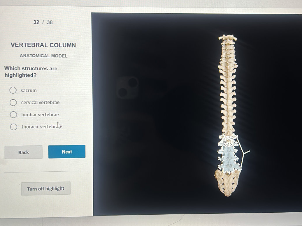 Which structures are highlighted? sacrum | StudyX