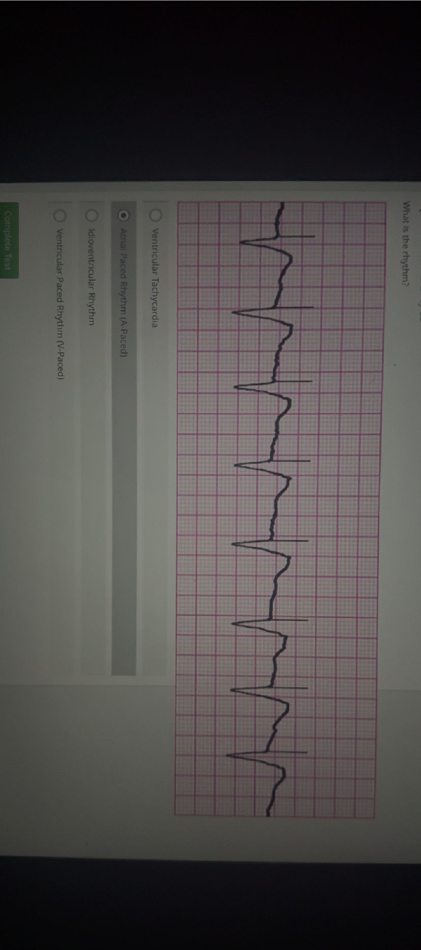 What is the rhythm? Ventricular Tachycardia | StudyX