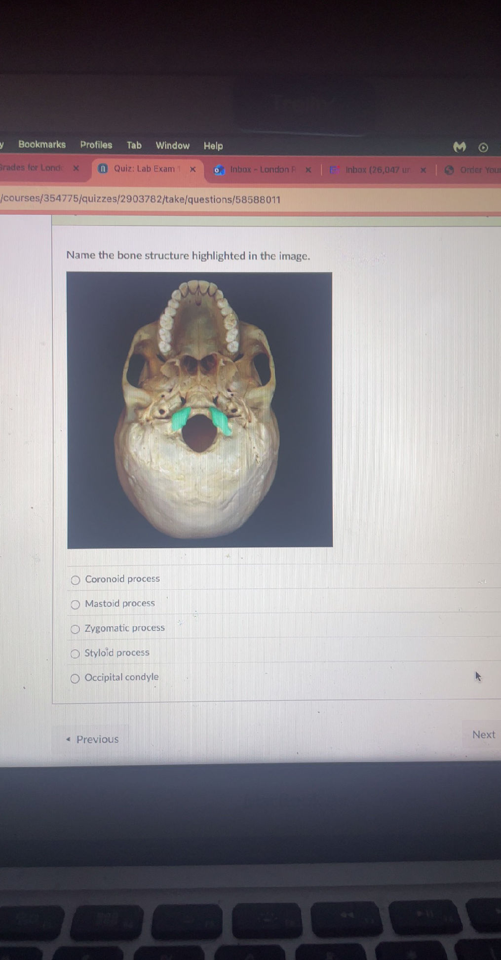 Name the bone structure highlighted in the | StudyX