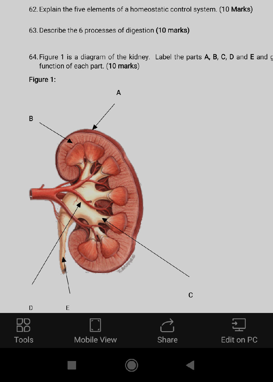 Figure 1 is a diagram of the kidney. Label | StudyX