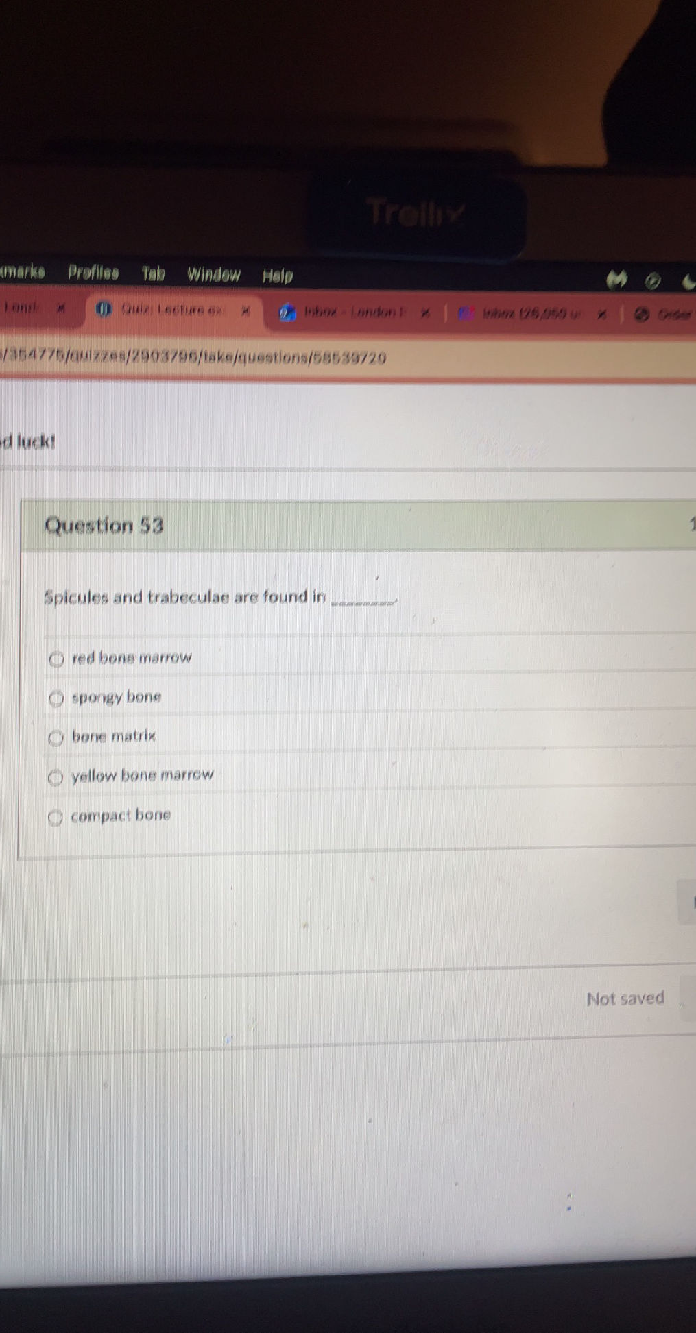 Question 53 Spicules and trabeculae are | StudyX
