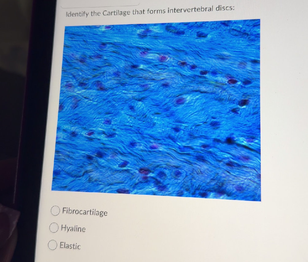 Identify the Cartilage that forms | StudyX