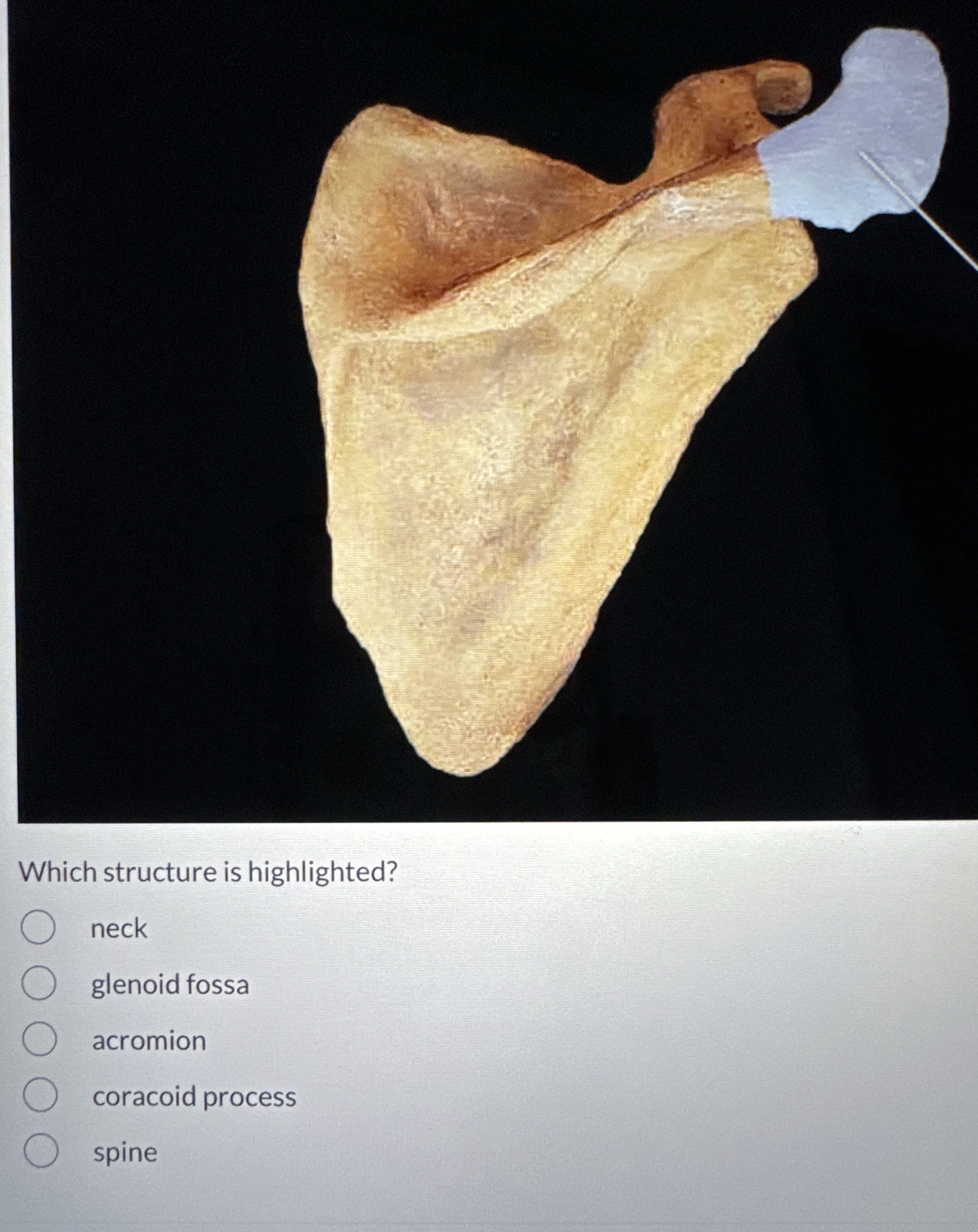 Which structure is highlighted? neck | StudyX