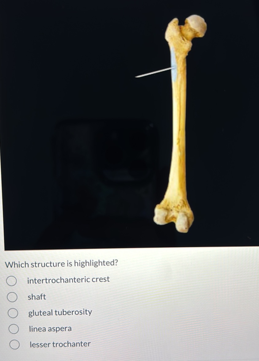 Which structure is highlighted? | StudyX