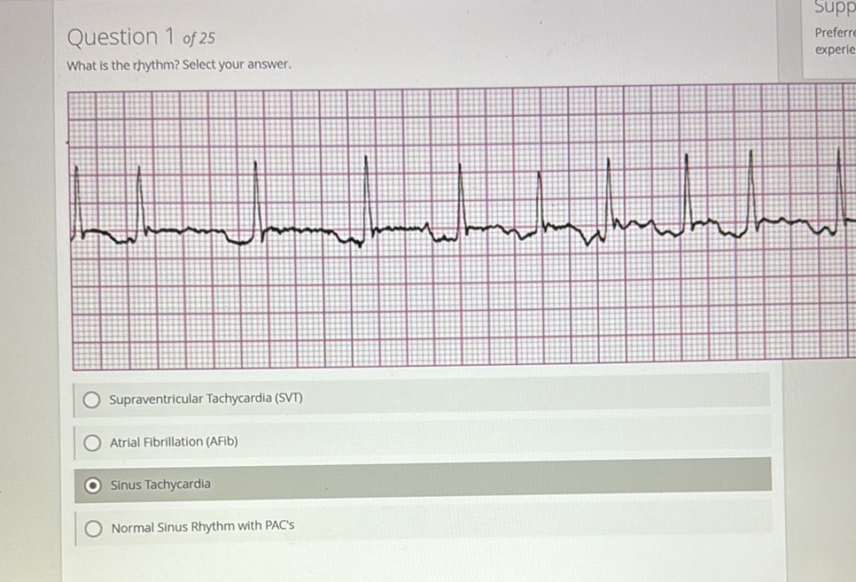 Question 1 of 25 What is the rhythm? Select | StudyX
