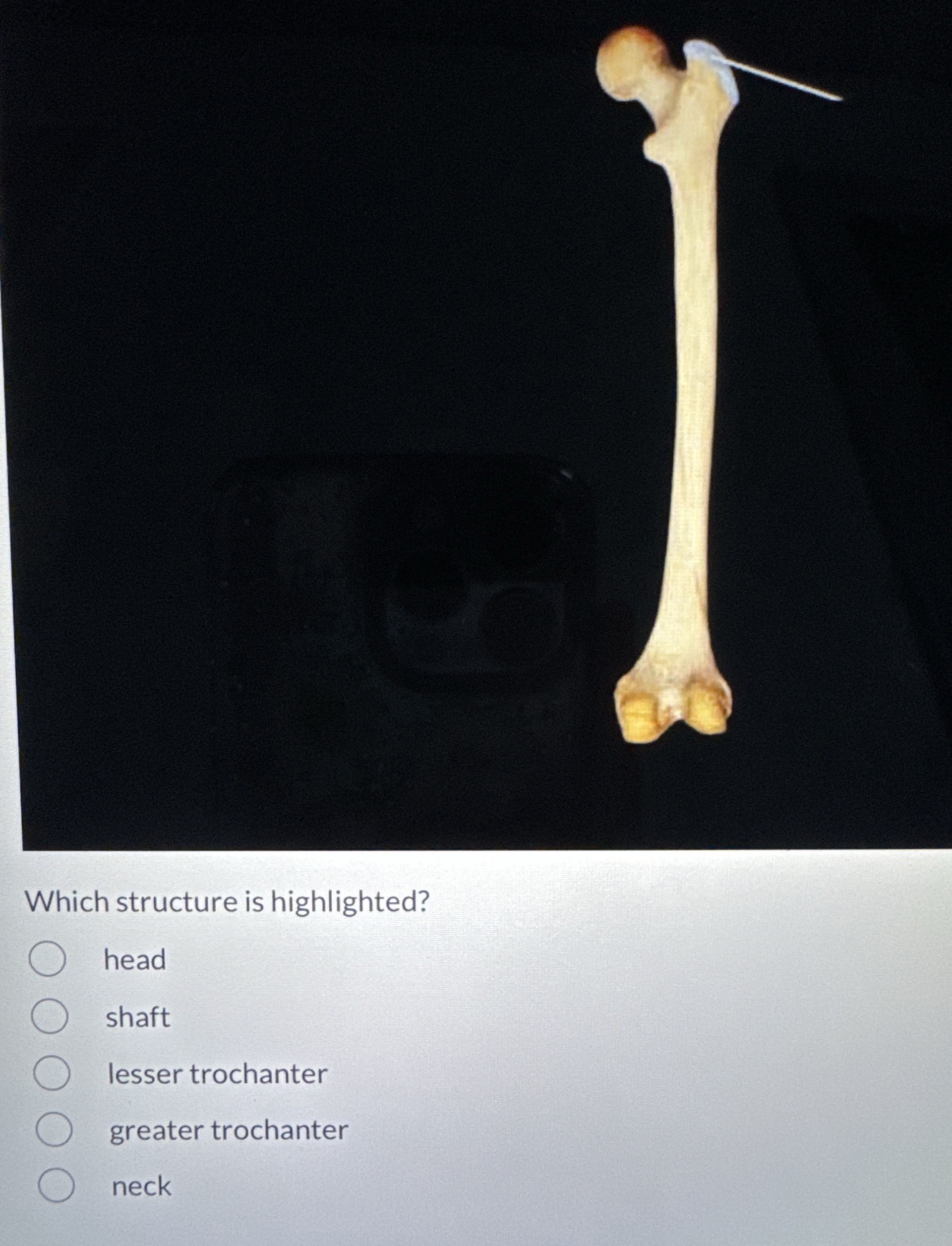 Which structure is highlighted? head shaft | StudyX