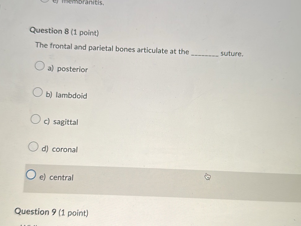 Question 8 (1 point) The frontal and | StudyX