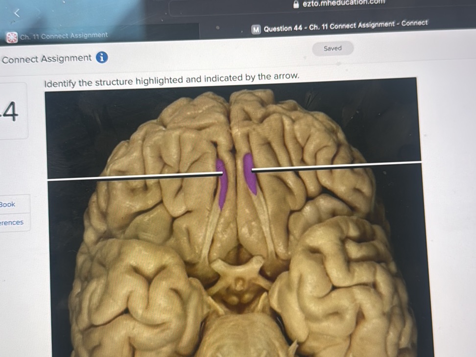 Identify the structure highlighted and | StudyX